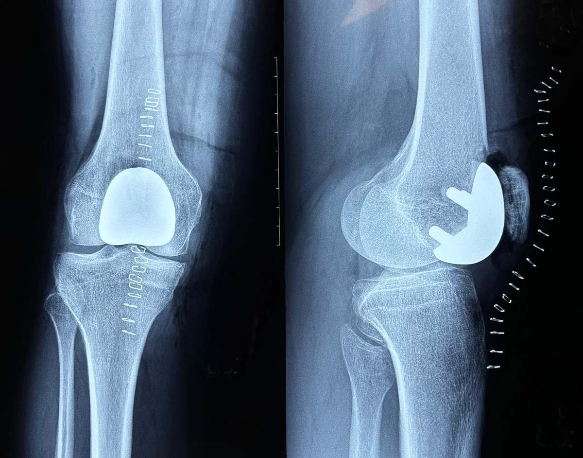 Specialista Roma iperpressione rotulea